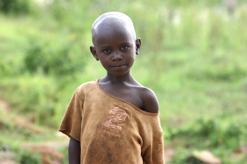 What Does Famine Look Like Around the World? | World Help